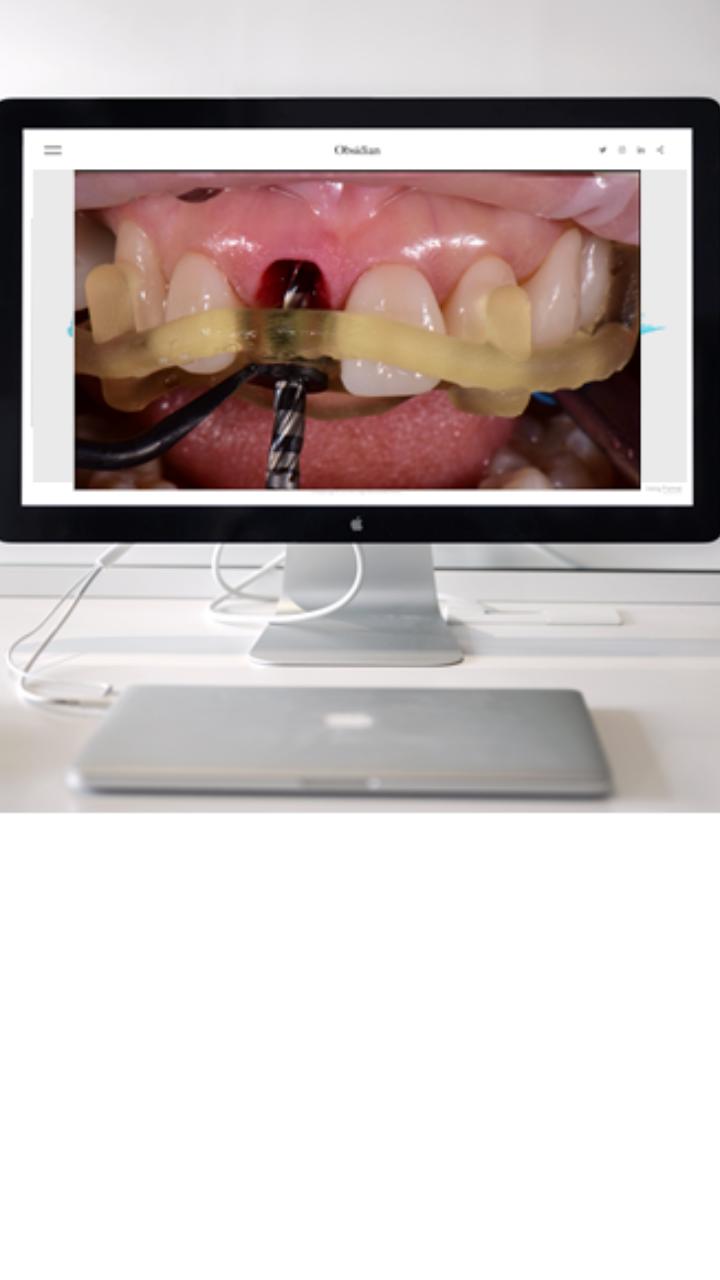 Descargar 3D Dental Implant en PC | GameLoop Oficial