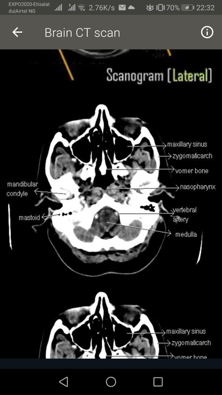 Download CT Scan of Brain android on PC