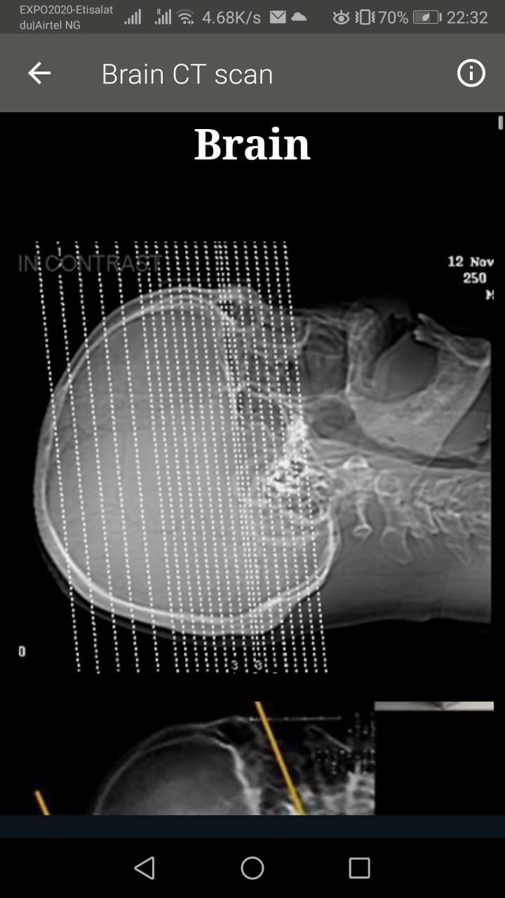 Download CT Scan of Brain android on PC